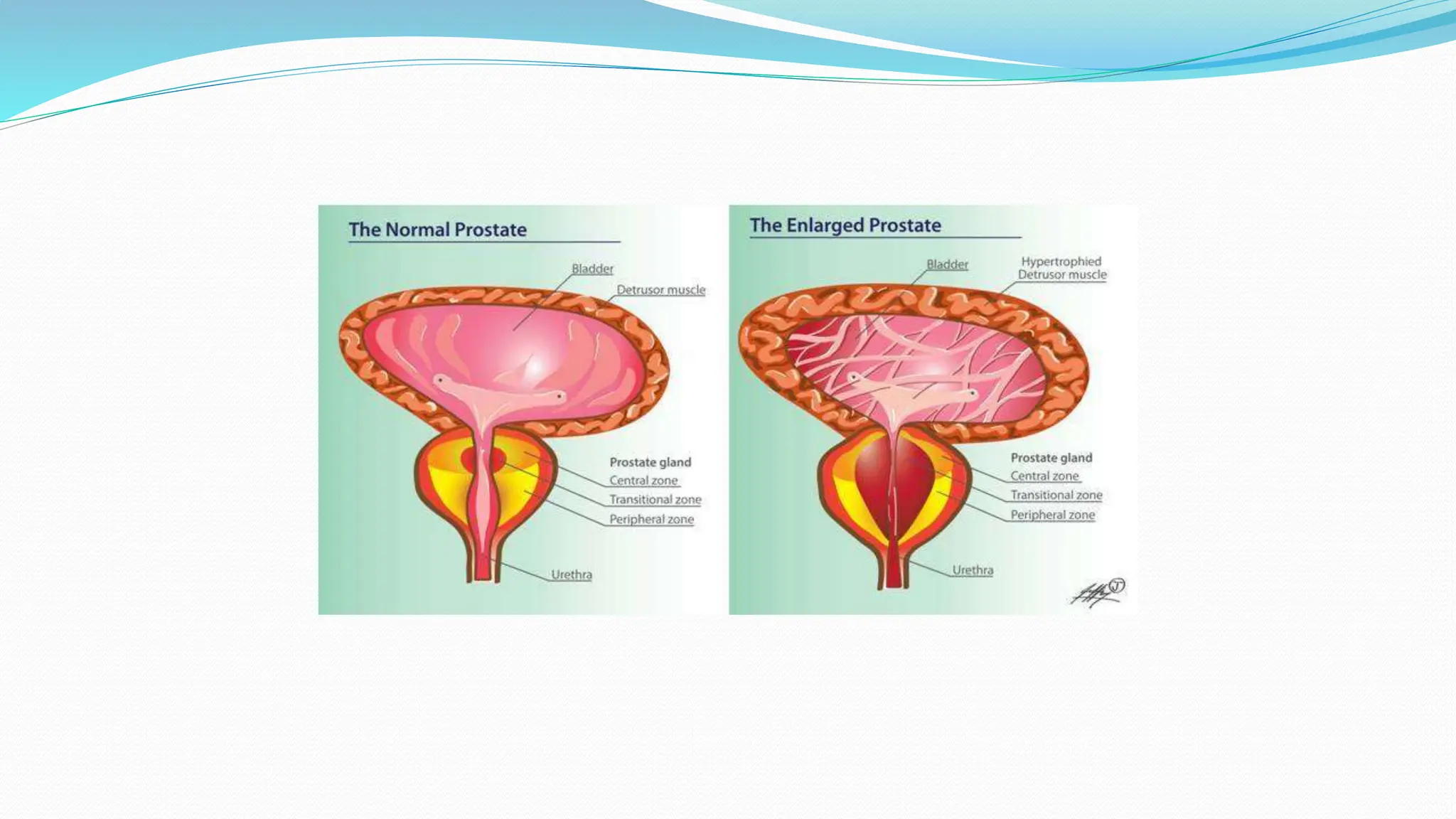 ANS alpha blockers drugs pharmacology.pdf