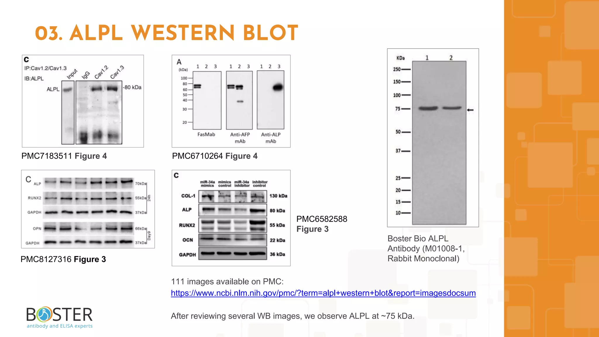 Learn ALPL in 3 minutes | Alkaline Phosphatase, ALP, TNAP | PPTX