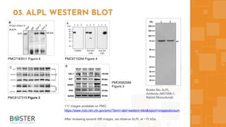 Learn ALPL in 3 minutes | Alkaline Phosphatase, ALP, TNAP | PPTX