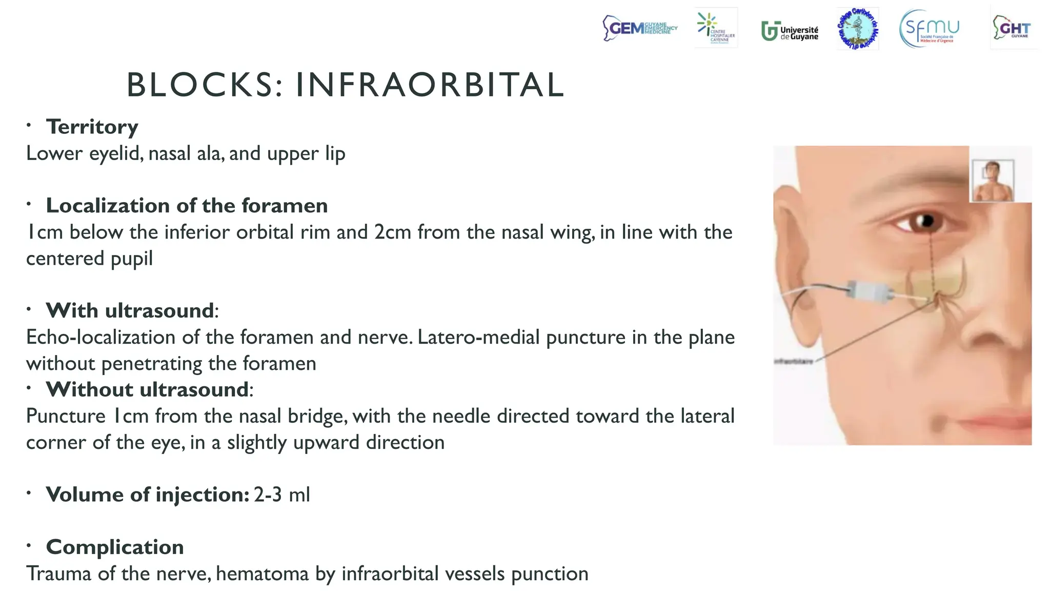 locoregional anesthesia - course -------- | PPT