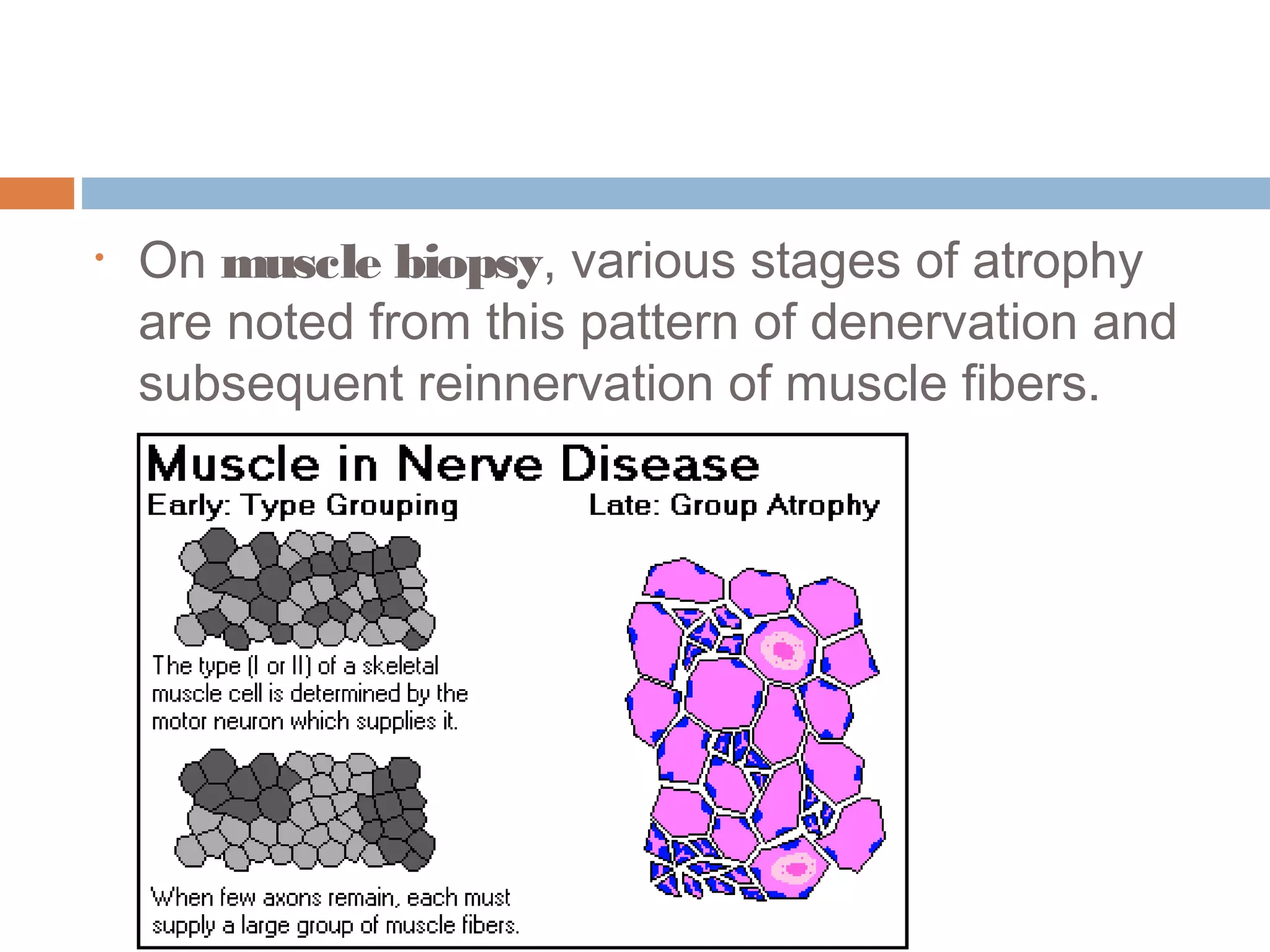 ALS - amyotrophic lateral sclerosis | PPT