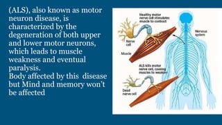 amyotrophic lateral sclerosis & Gehrig's disease & moror neuron disease ...