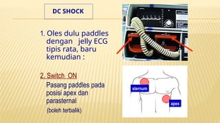 Advance life support (bantuan hdup).pptx
