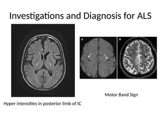 ALS_Detailed_Academic_Presentation .pptx