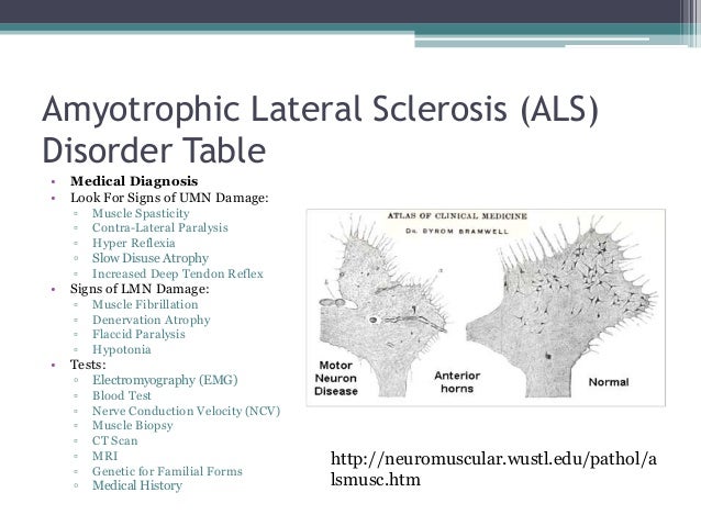 Neuromuscular Disorders