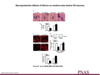 lithium in treatment of motor neuron disease | PPT