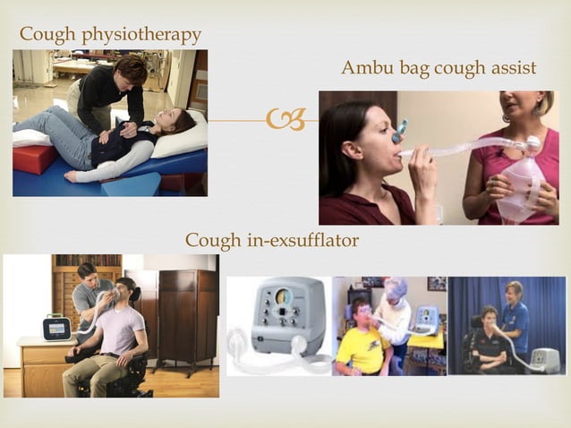 ALS and Noninvasive ventilation | PPT