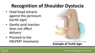 Obstetrics slide on shoulder dystocia and management | PDF