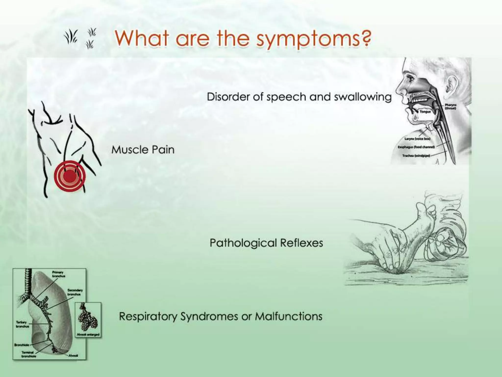 ALS Treatment in India | Stem Cell Treatment for ALS | PPTX