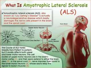 ALS Treatment in India | Stem Cell Treatment for ALS | PPTX | Physical ...