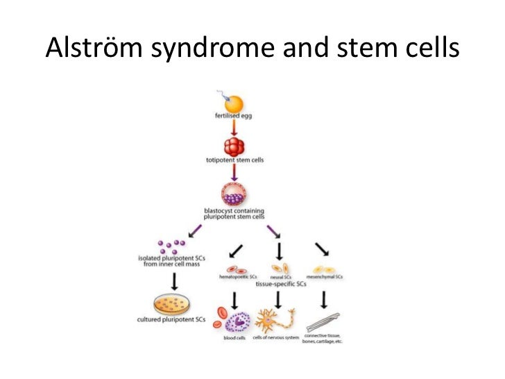 Alström syndrome