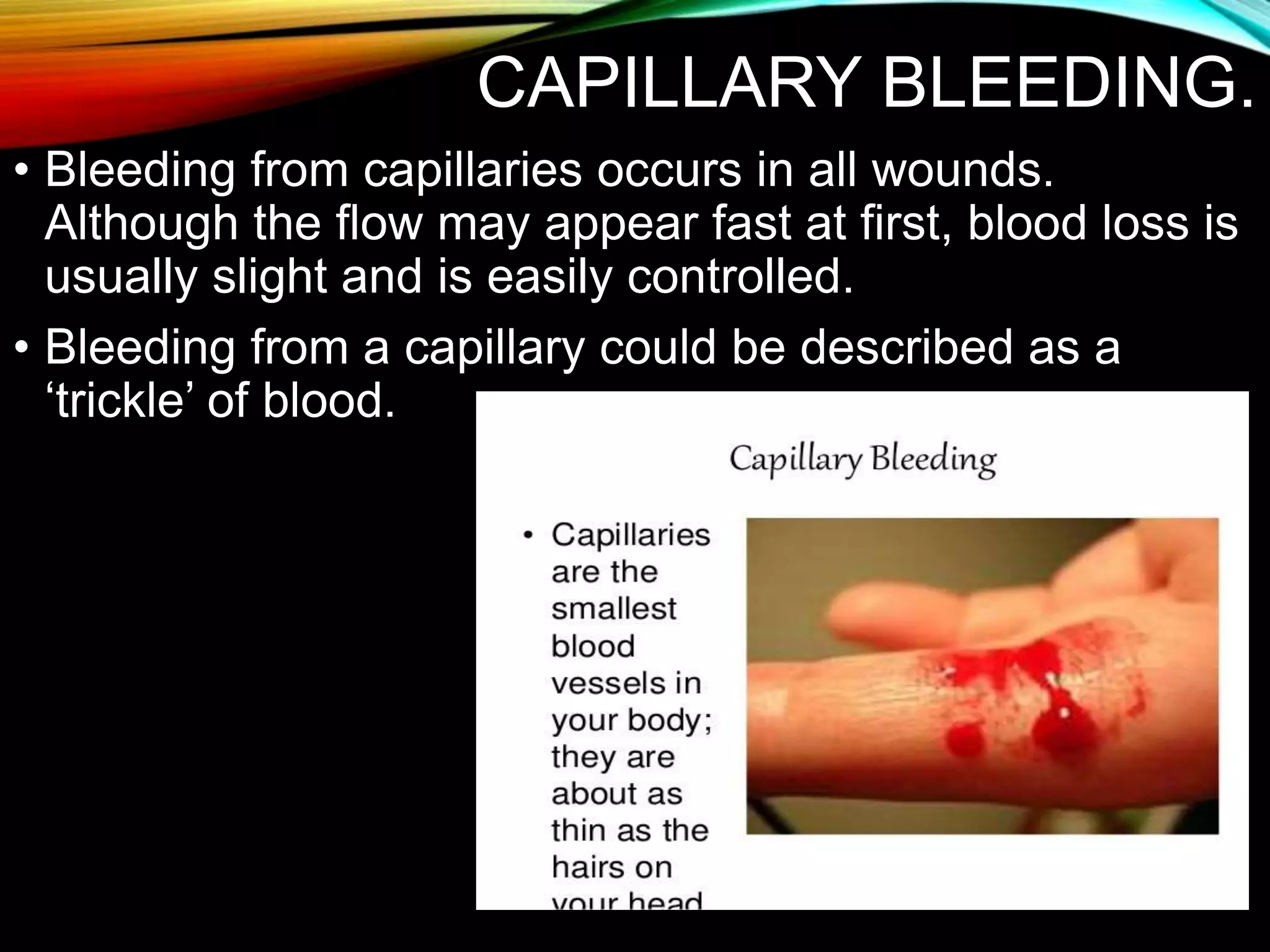 Perioperative bleeding and Hemostasis | PPTX