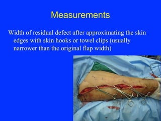 ALT flap donor defect closure.pptx
