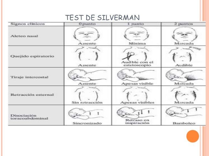 Altearaciones respiratorias diapo