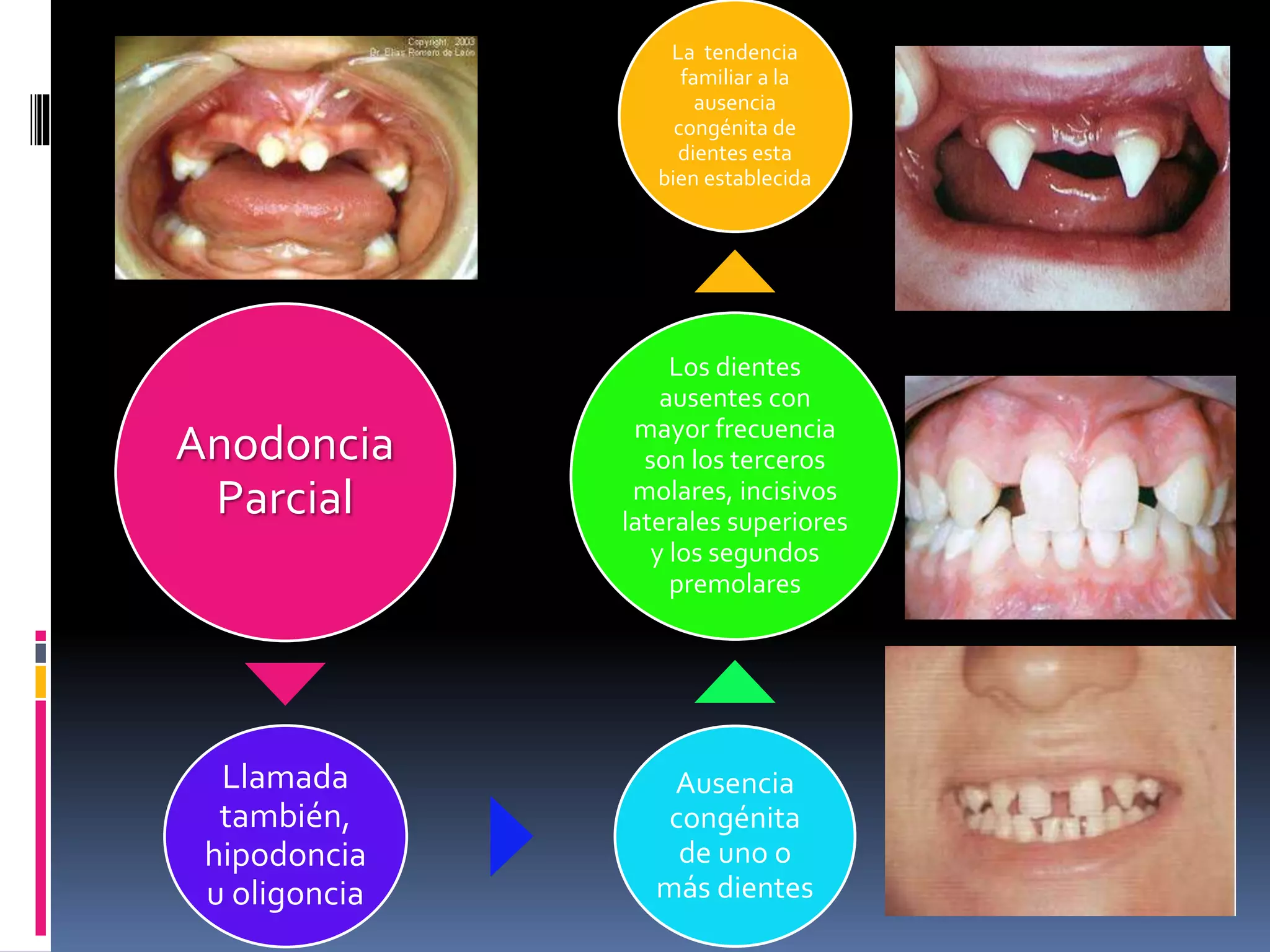 Alteraciones del desarrollo | PPTX