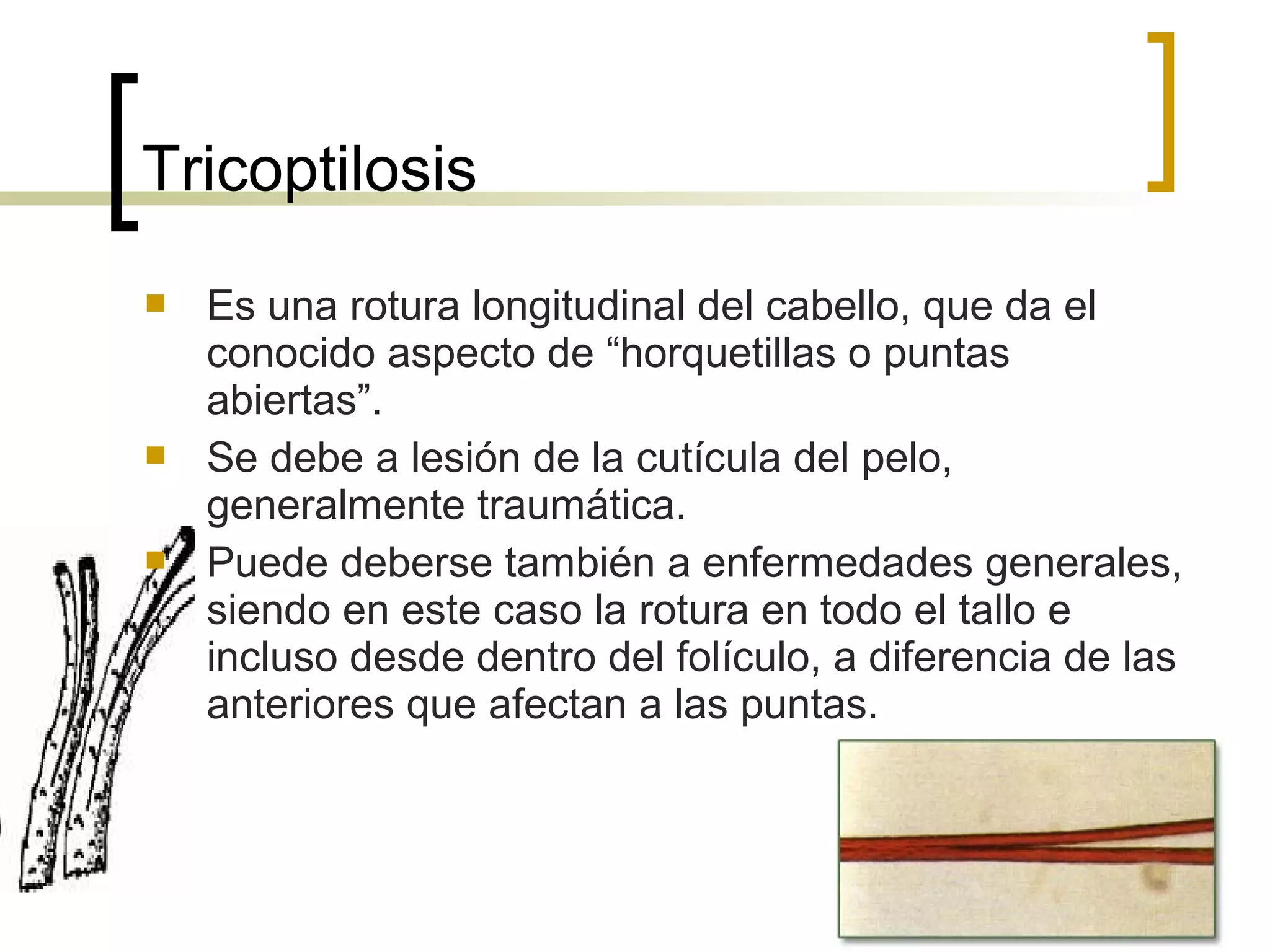 Alteraciones Estructurales Del Tallo Capilar | PPT