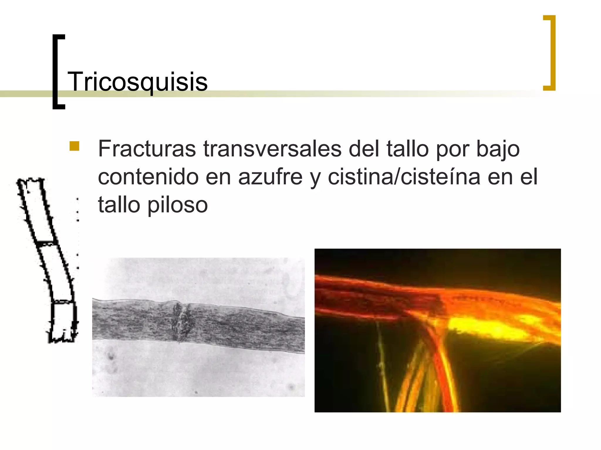 Alteraciones Estructurales Del Tallo Capilar | PPT