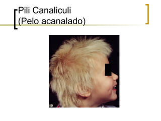 Alteraciones Estructurales Del Tallo Capilar | PPT