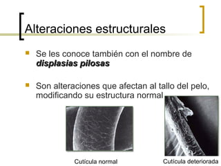 Alteraciones Estructurales Del Tallo Capilar | PPT