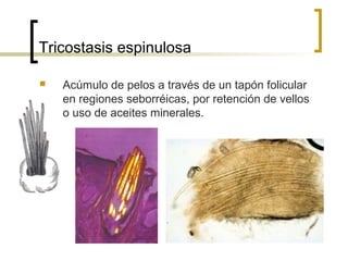 Alteraciones Estructurales Del Tallo Capilar | PPT