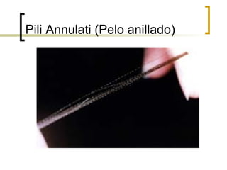 Alteraciones Estructurales Del Tallo Capilar | PPT