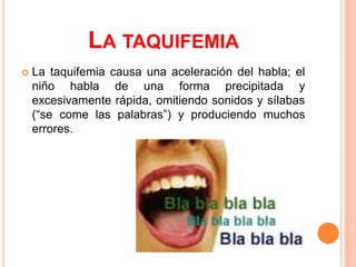 Alteraciones de escritura | PPTX