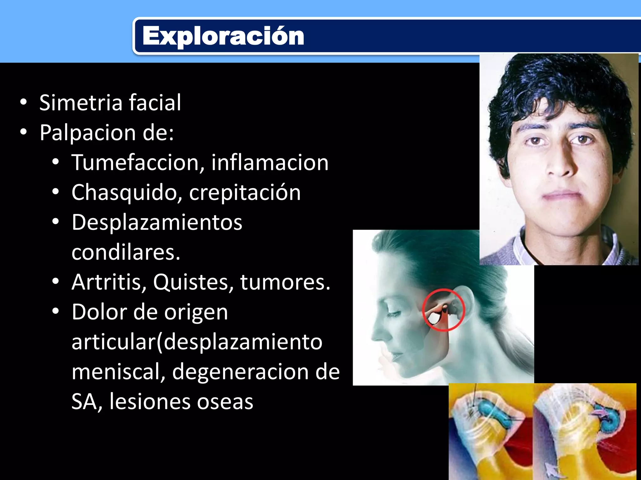 Alteraciones de la articulacion temporomandibular ATM | PDF