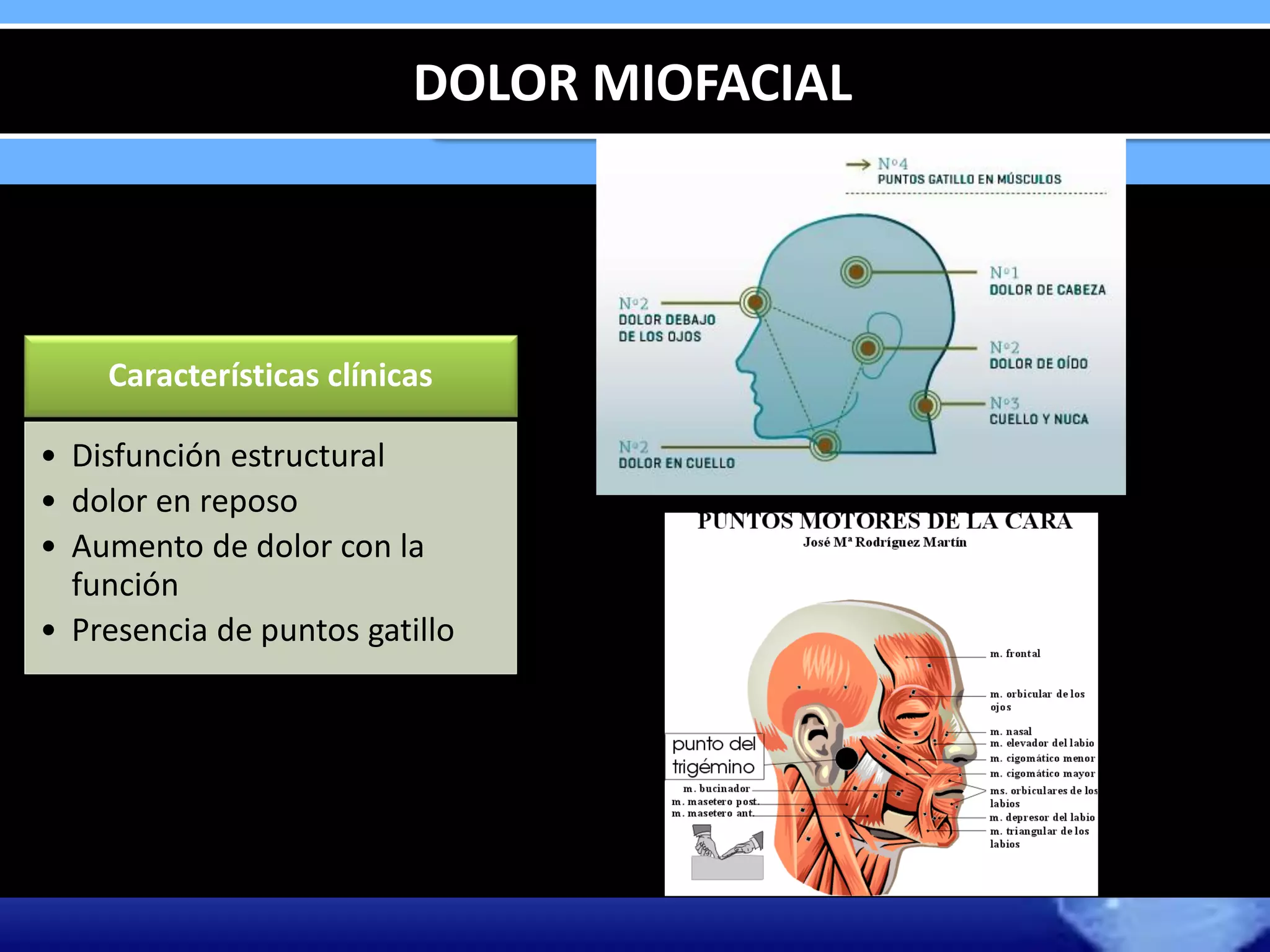 Alteraciones de la articulacion temporomandibular ATM | PDF