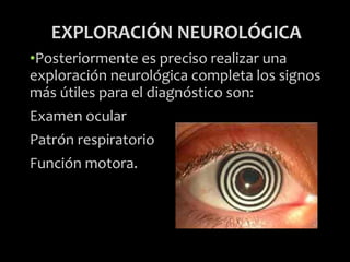 Alteraciones de la conciencia estupor y coma | PPT