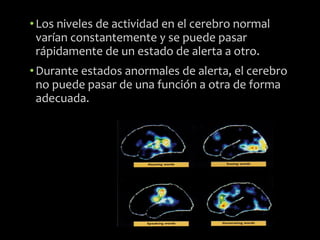 Alteraciones de la conciencia estupor y coma | PPT