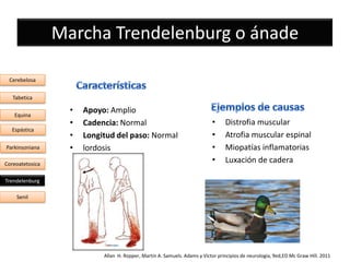 Alteraciones de la marcha | PPTX