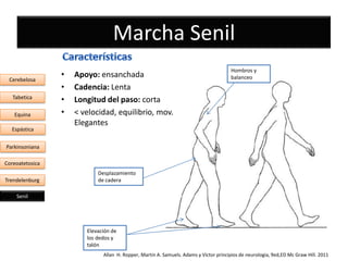 Alteraciones de la marcha | PPTX