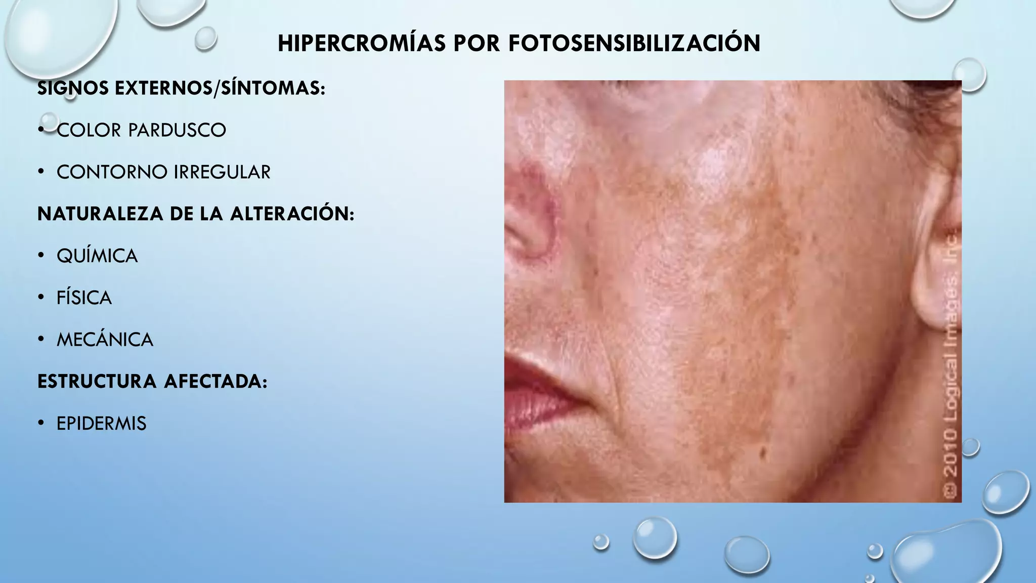 ALTERACIONES DE LA PIGMENTACIÓN.pdf
