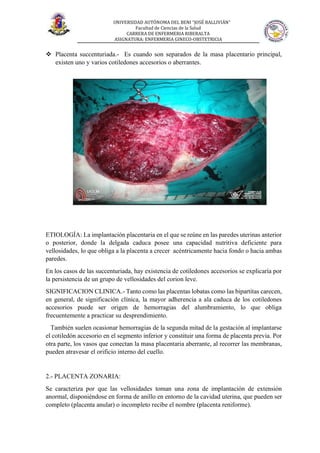 alteraciones de la placenta, Malformaciones de la placenta.pdf