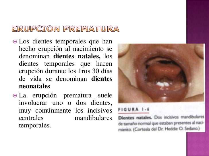Alteraciones del desarrollo de la region oral