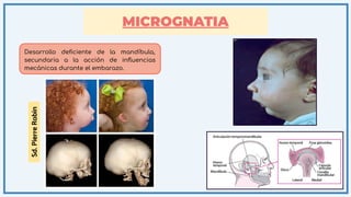 Alteraciones del Desarrollo MaxiloFacial (Tipos de Mordidas ...