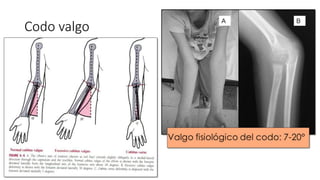 Alteraciones del miembro superior comunes | PDF