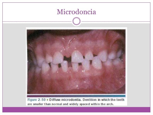 ANOMALIAS DENTARIAS - Mind Map