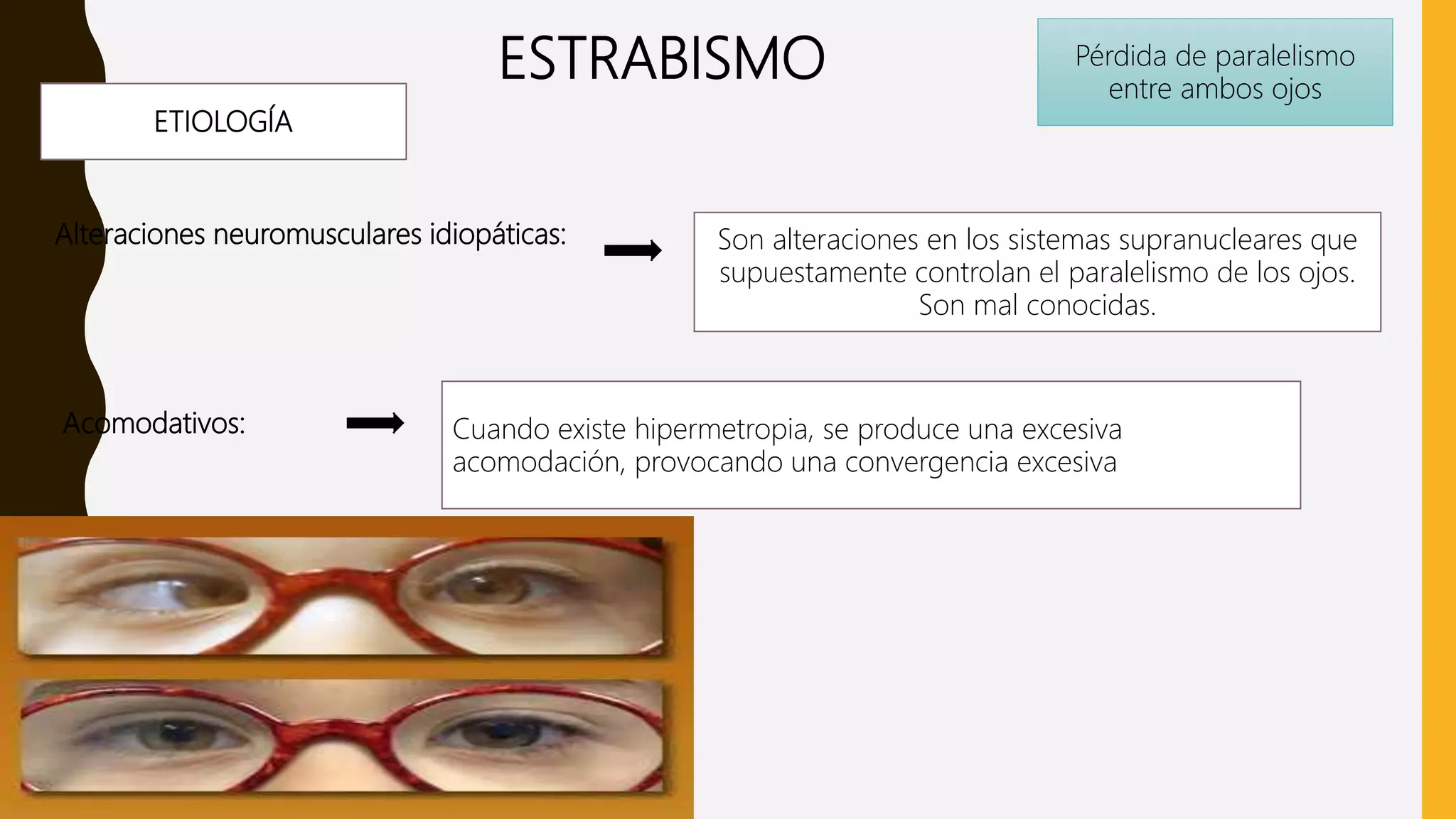Alteraciones de los movimiento oculares | PPTX