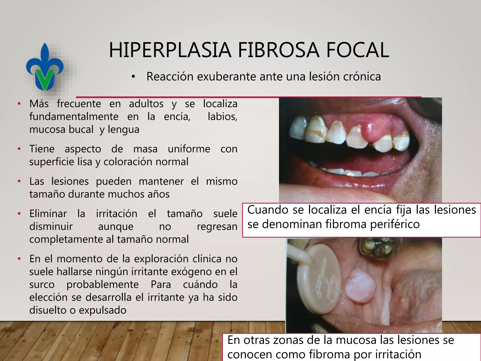 Alteraciones del Tejido Conjuntivo.pptx