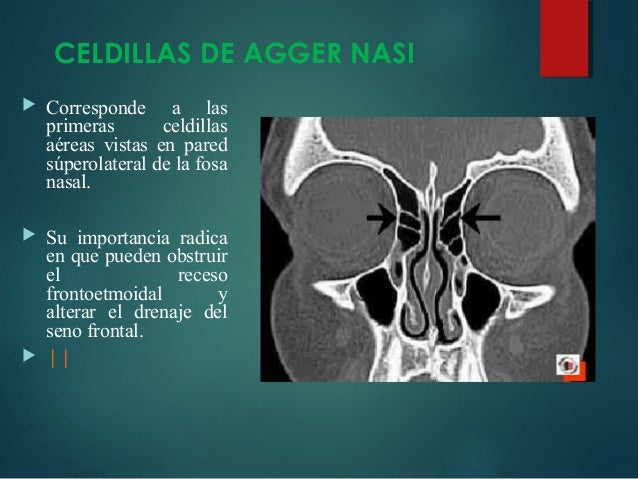 SENOS PARANASALES VARIANTES ANATOMICAS