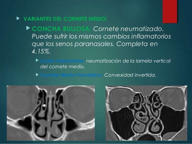 SENOS PARANASALES VARIANTES ANATOMICAS