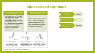 Alteraciones electrocardiográficas | PPTX