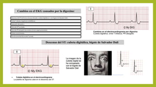 Alteraciones electrocardiográficas | PPTX
