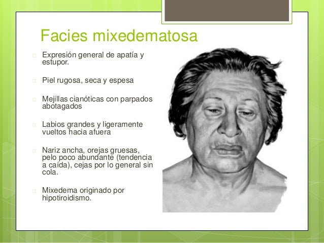 Alteraciones en el_examen_fã sico_general