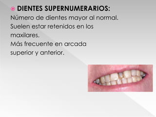 Alteraciones en el tamaño, la forma y numero | PPTX