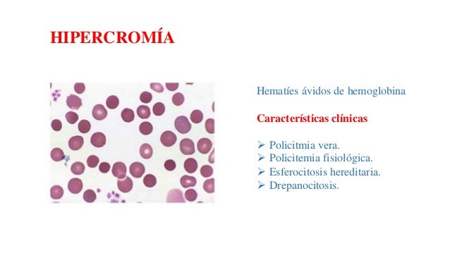 Alteraciones eritrocitarias