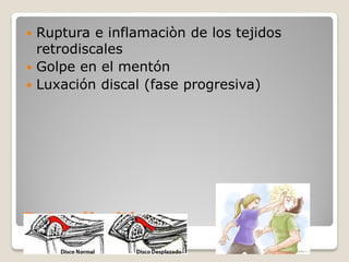 Alteraciones funcionales de la atm | PDF