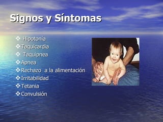 Alteraciones metabolicas del recien nacido | PPT