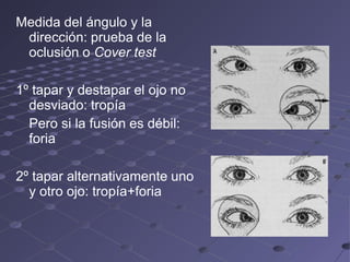 ALTERACIONES OFTALMOLOGICAS.pptx